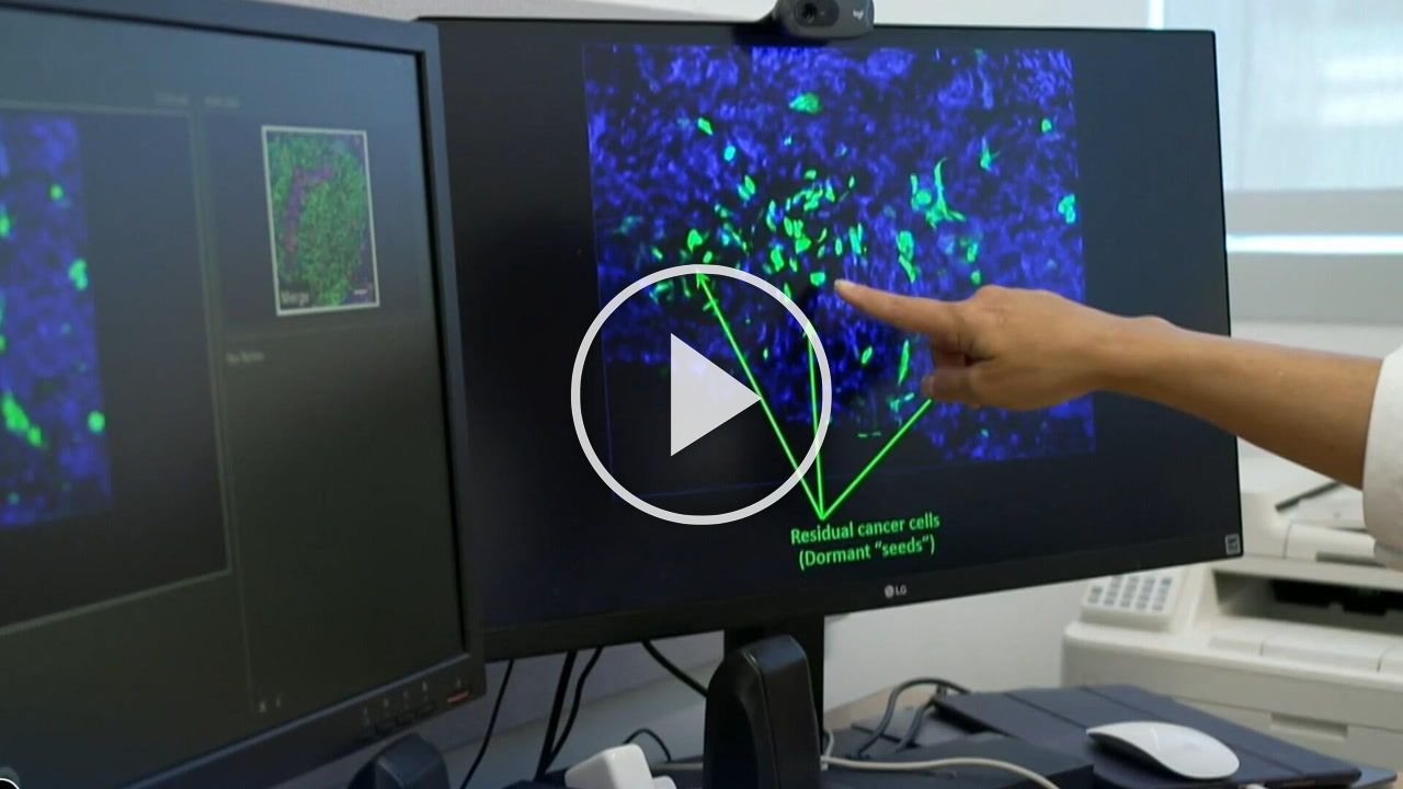 Scientists seek to wipe out breast cancer's 'sleeper cells'